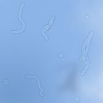 Protein in Eyes: What Are Eye Floaters Made Of? - Natural Eye Care
